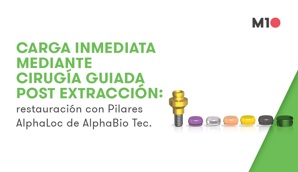 Carga inmediata mediante cirugía guiada con pilares AlphaLoc